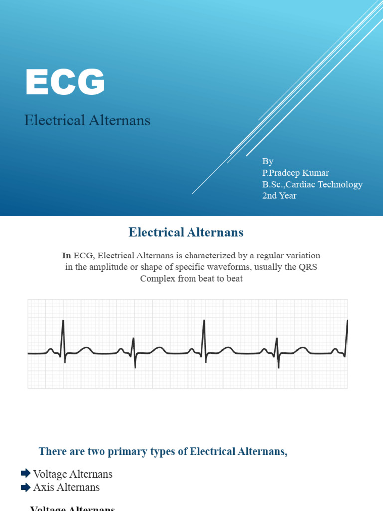 ECG-Electrical Alternans | PDF | Science & Mathematics
