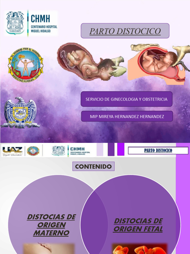 Parto Distocico | PDF | Parto | Especialidades Medicas