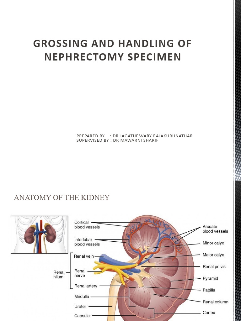 Nephrectomy Macroscopic Handling | PDF | Kidney | Neoplasms
