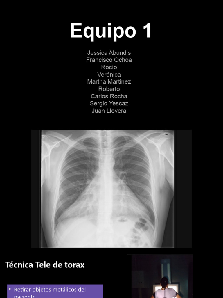 Expo Eq1 | PDF | Enfermedades y trastornos | Especialidades Medicas