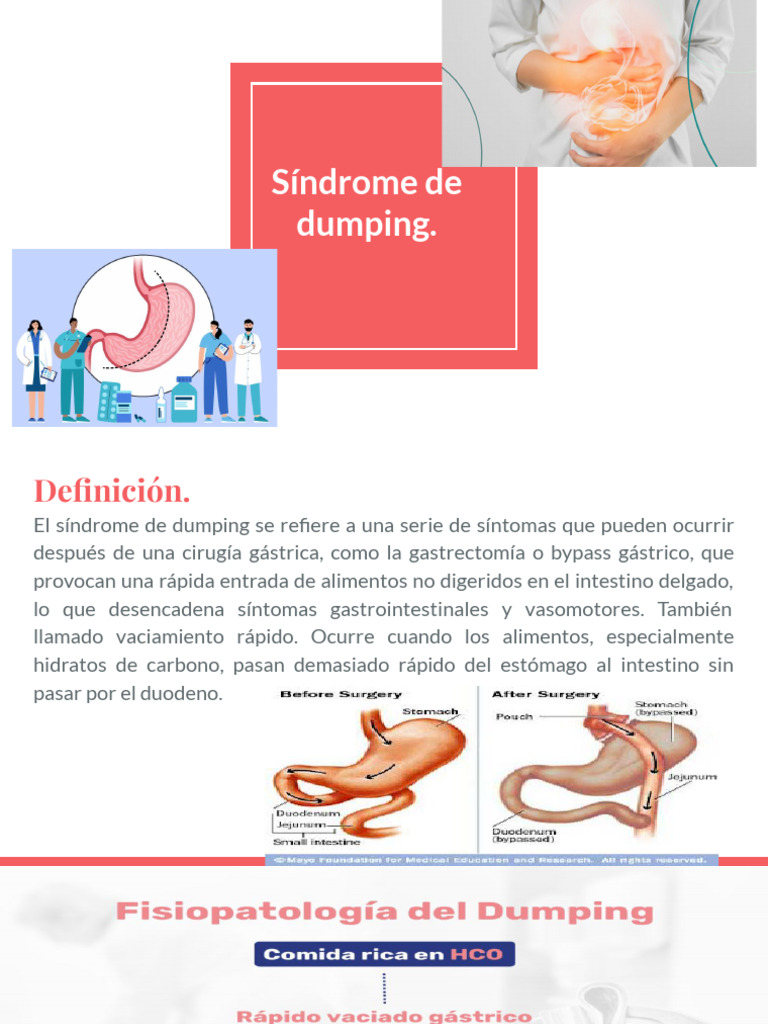 Sindrome de Dumping. | PDF | Alimentos | Síndrome