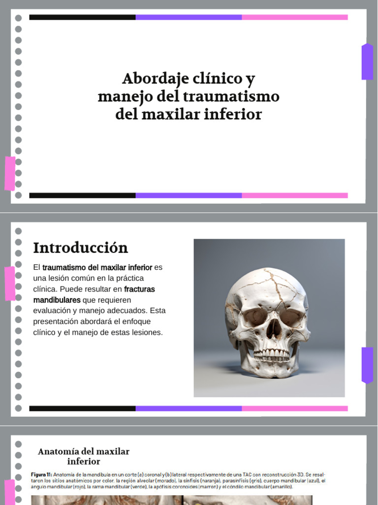 Manejo del traumatismo mandibular | PDF | Medicina CLINICA ...