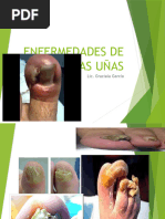 Onicogrifosis Congénita - Uña | PDF | Clavo (anatomía) | Dermatología