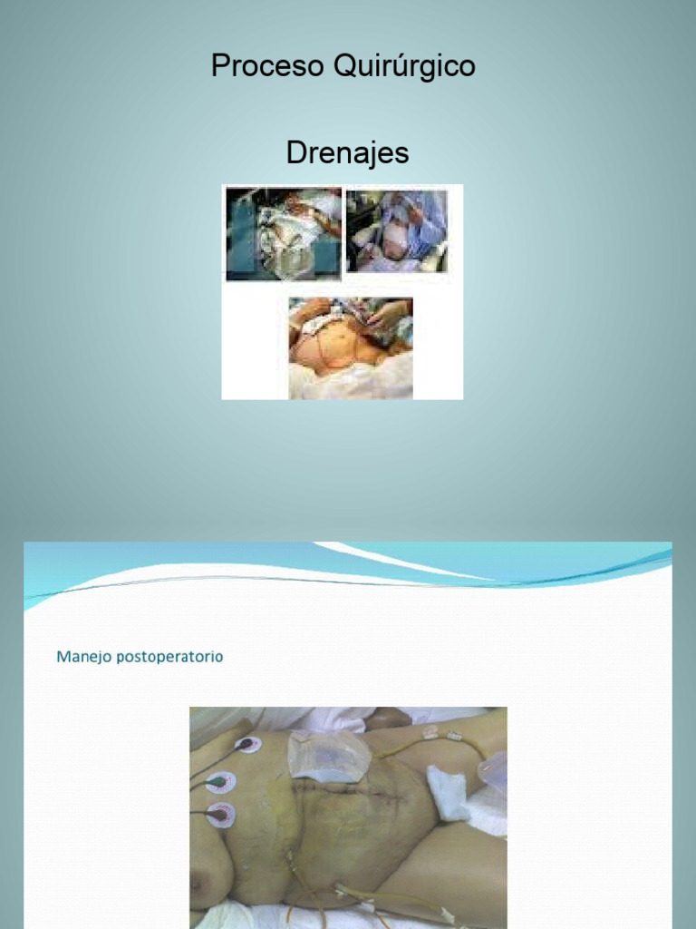 Clase 6 Drenajes | PDF | Especialidades Medicas | Medicina CLINICA