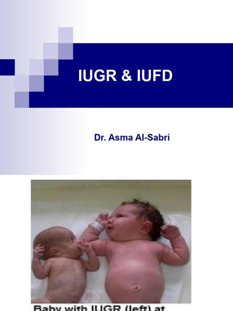 Iugr & Iufd د.اسماء | PDF | Fetus | Childbirth