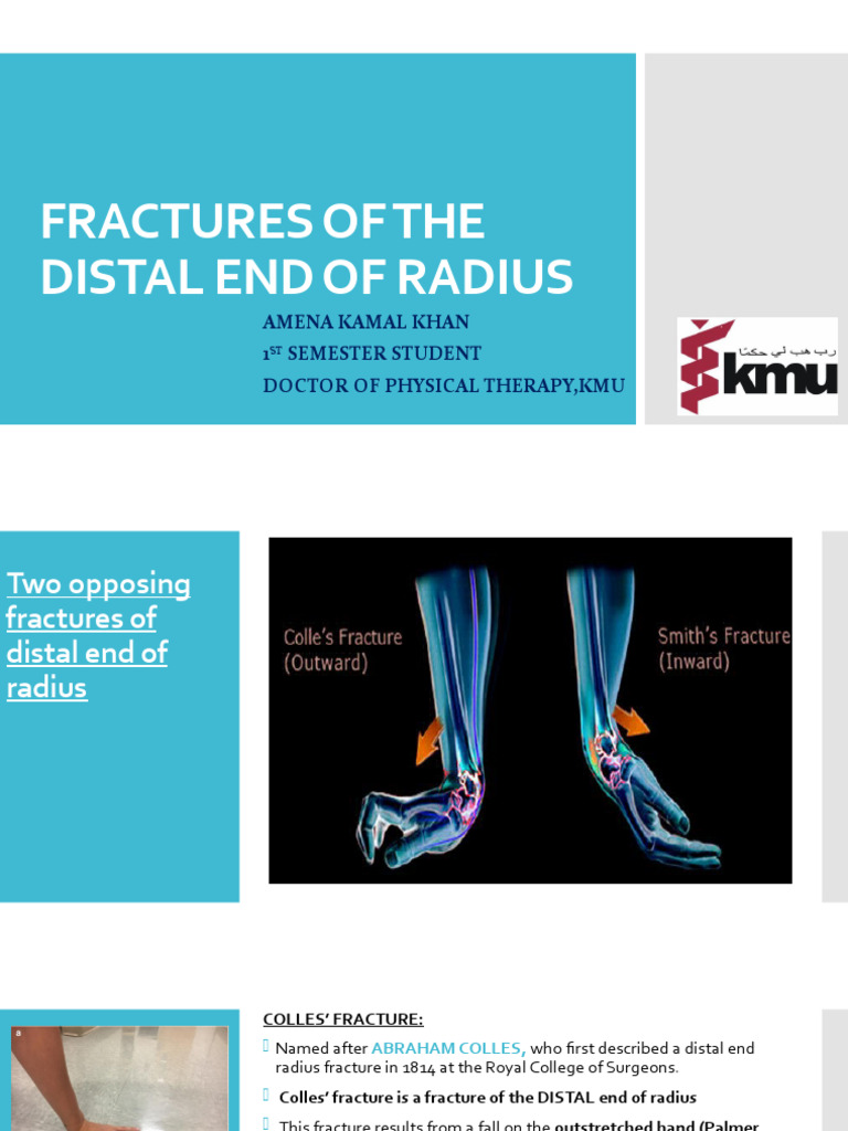 Distal Radial Fractures. | PDF | Skeletal System | Musculoskeletal ...