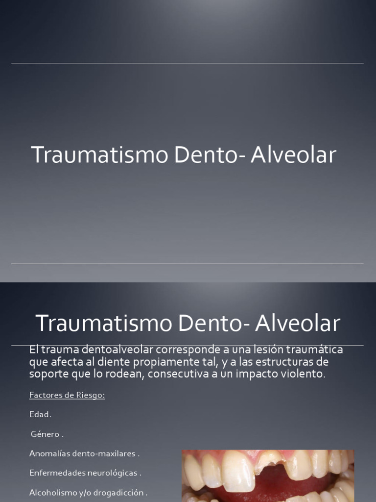 Traumatismos Dento Alveolares | PDF | Dentina | Esmalte de dientes