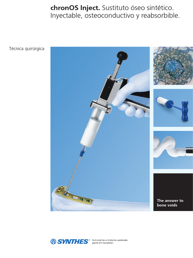 Chronos Inject | Descargar gratis PDF | Hueso | Inyección (medicina)