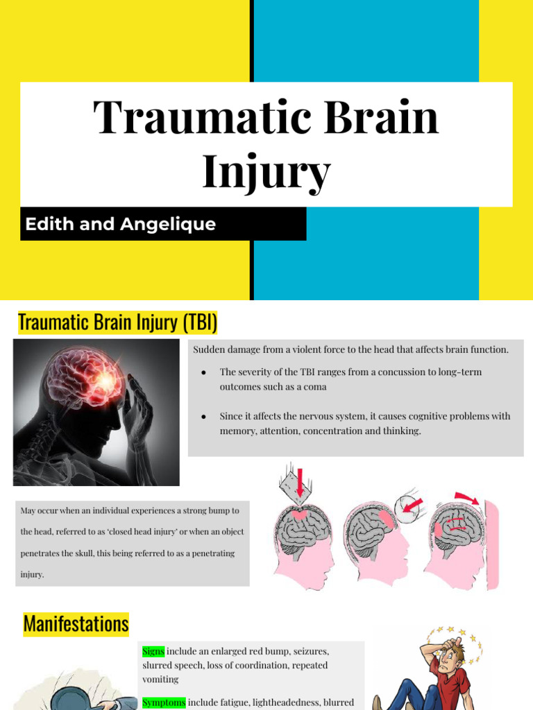 Tbi - Powerpoint | PDF | Traumatic Brain Injury | Concussion
