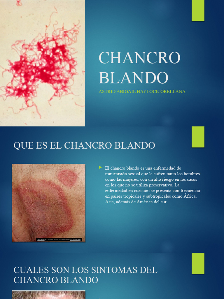 Chancro Blando: Síntomas y Prevención | PDF | Infección transmitida ...