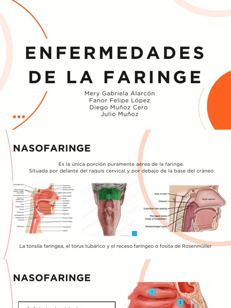 Enfermedades de La Faringe | Descargar gratis PDF | Cáncer | Neoplasias