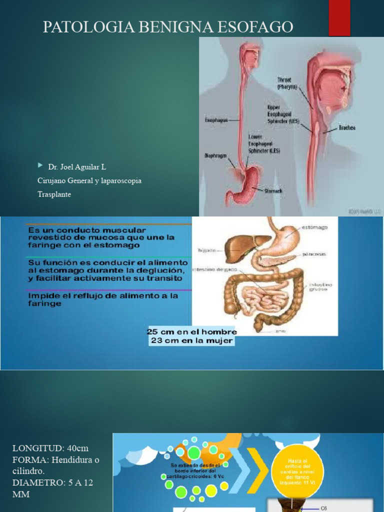 Clase Patologia Esofago | PDF | La enfermedad por reflujo ...