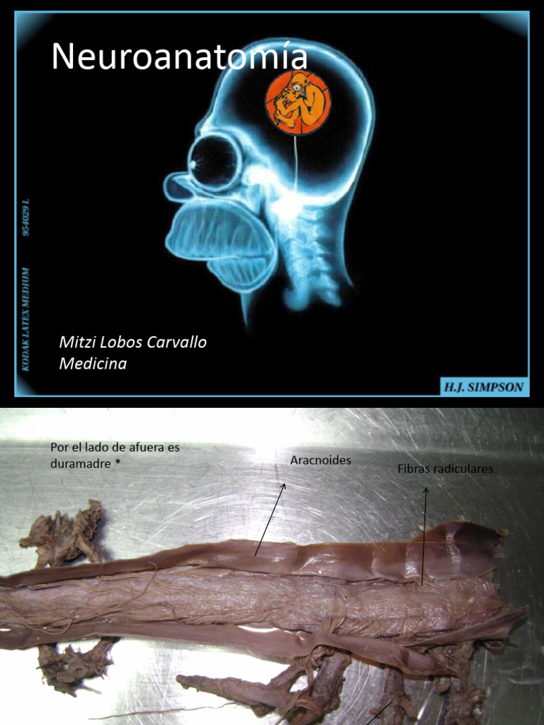 Muestras de Neuroanatomía UACh | PDF | Cerebelo | Anatomía