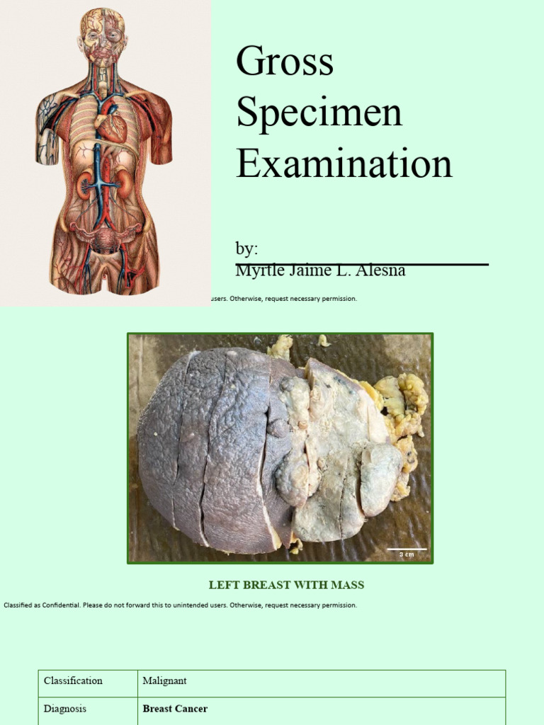 Gross Specimen Examination Download Free Pdf Ovarian Cancer Breast