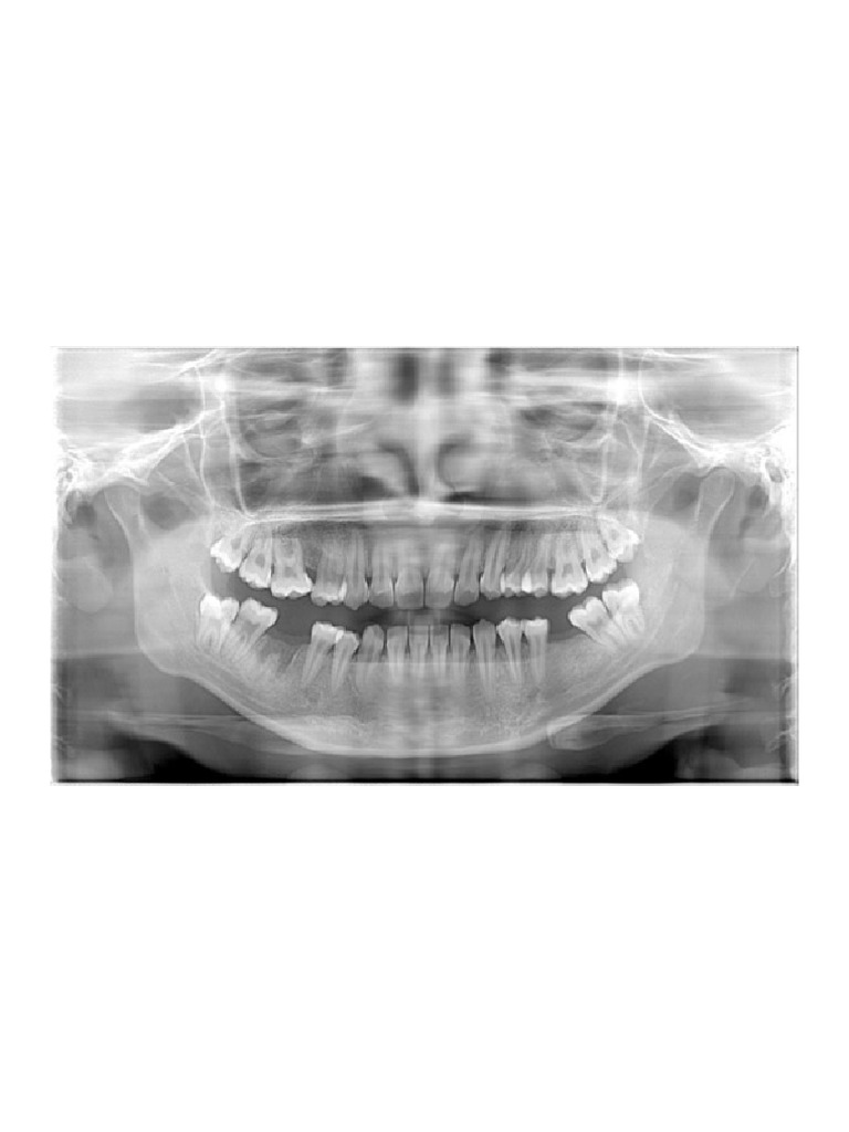 Contoh Rontgen Panoramik | PDF