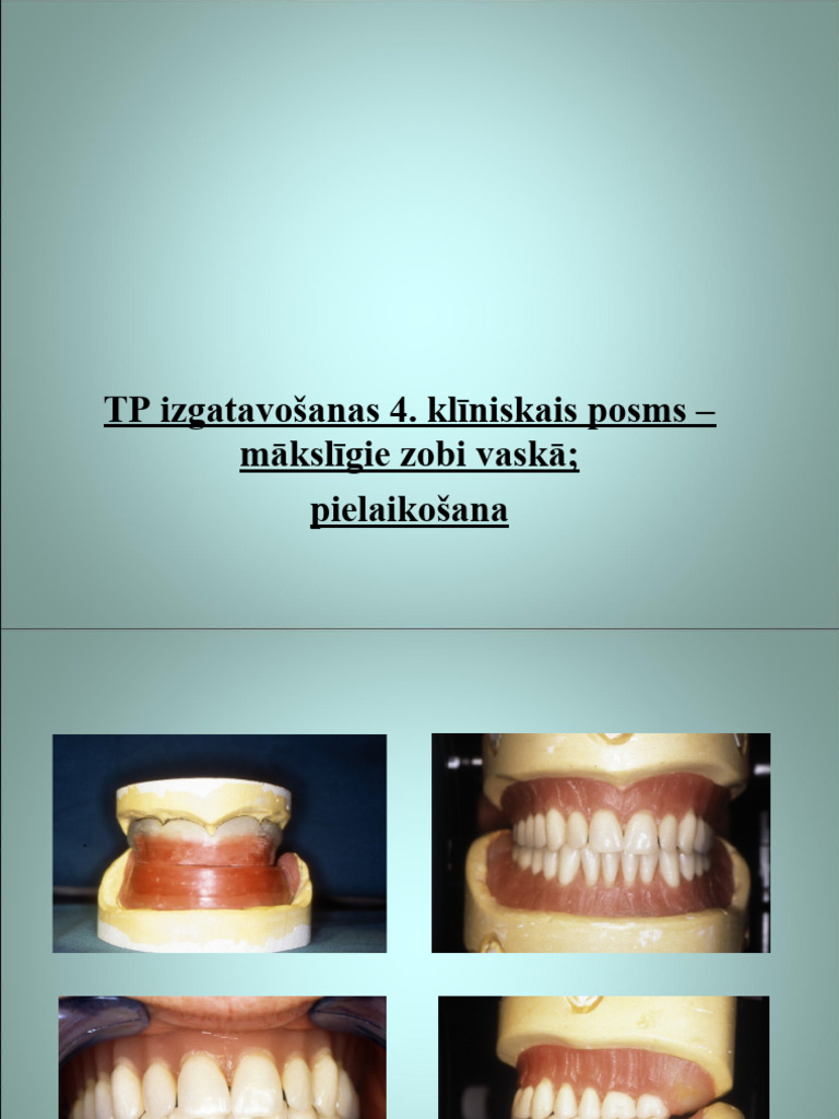 Zobi Vaska | PDF