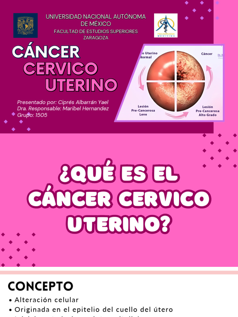 Cáncer Cervicouterino - 20240523 - 053519 - 0000 | Descargar gratis PDF | Cáncer de cuello ...