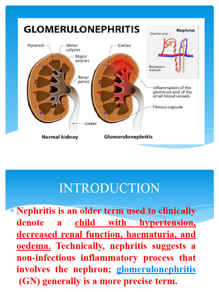 Nephritis | PDF | Hypertension | Kidney Disease