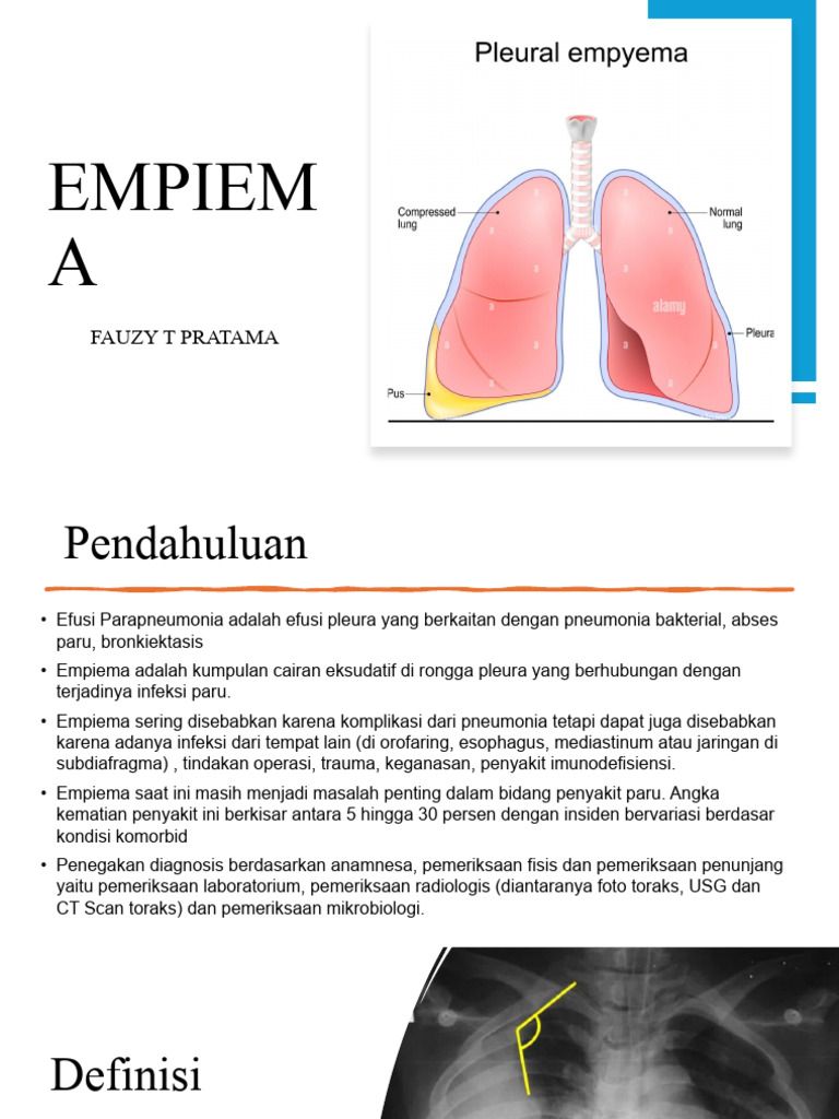 EMPIEMA | PDF