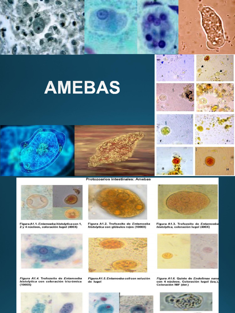 Amebas ppt21 | PDF | Biología
