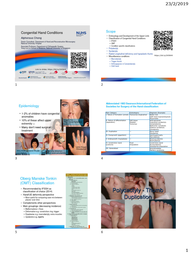 Classification of Congenital Hand Anomalies | PDF | Hand | Medical ...