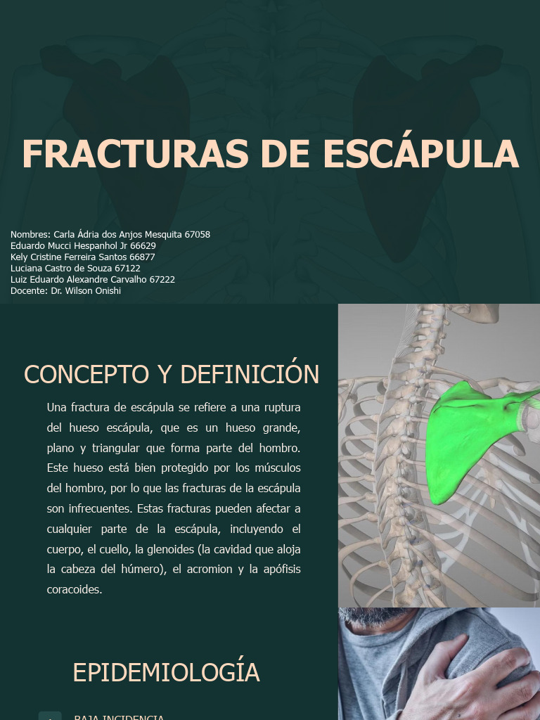 Fracturas de Escapula slide | Descargar gratis PDF | Hombro | Sistema ...