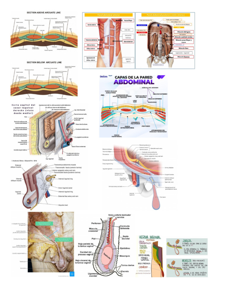 Hernias | PDF