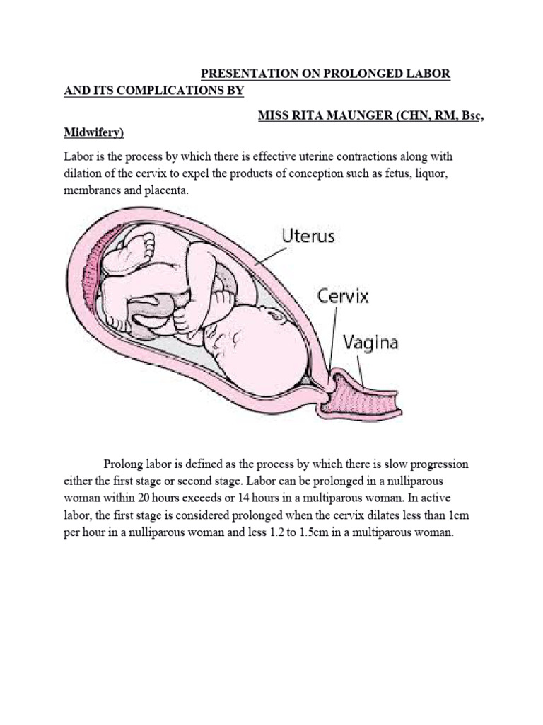 Prolonged Labor | PDF | Technology & Engineering