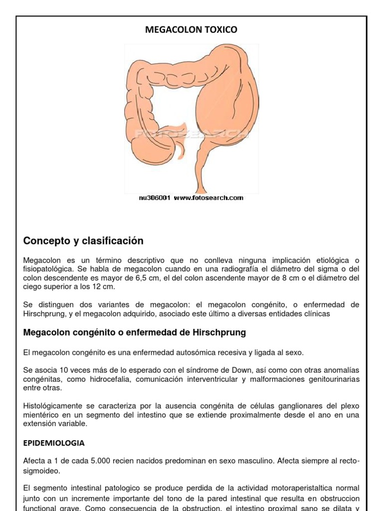 MEGACOLON TOXICOcorregido | PDF | Estreñimiento | Diarrea