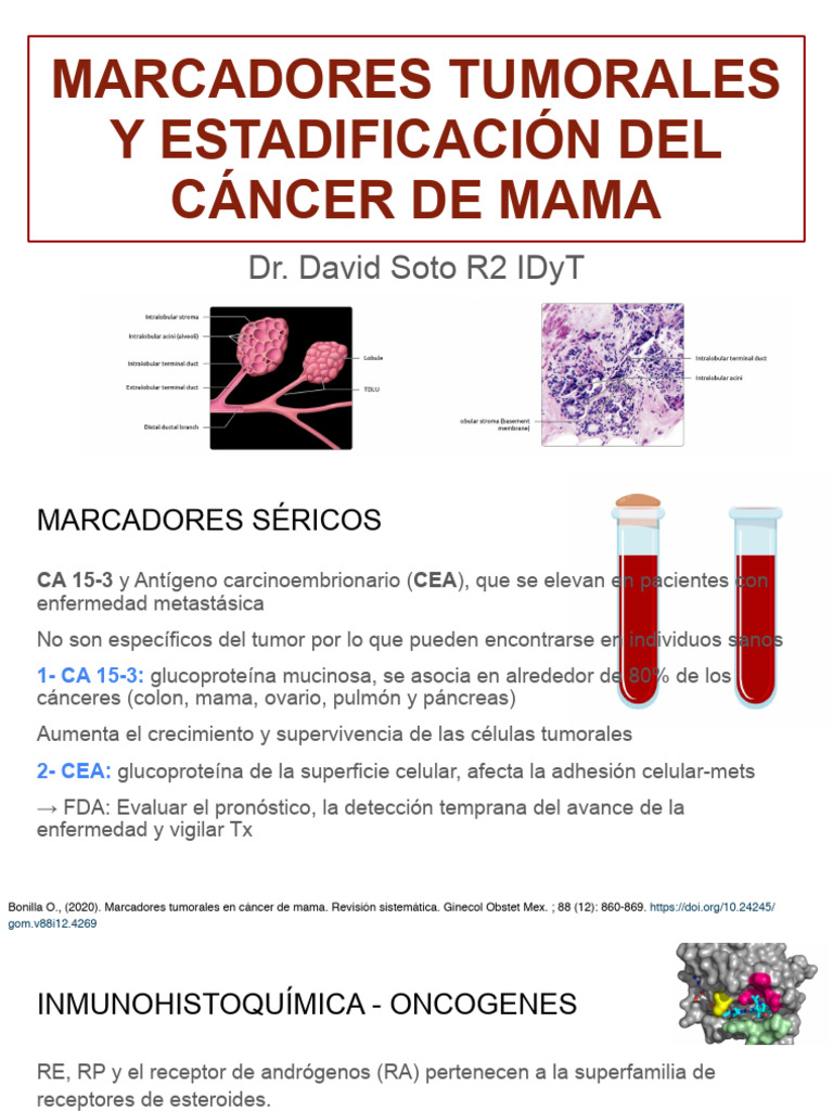 Marcadores Tumorales y Estadificación Del Cáncer de Mama | PDF | Cáncer | Metástasis