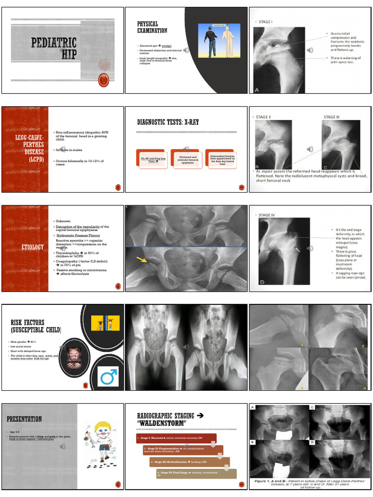 8 Pediatric Hip | PDF | Diseases And Disorders | Musculoskeletal System