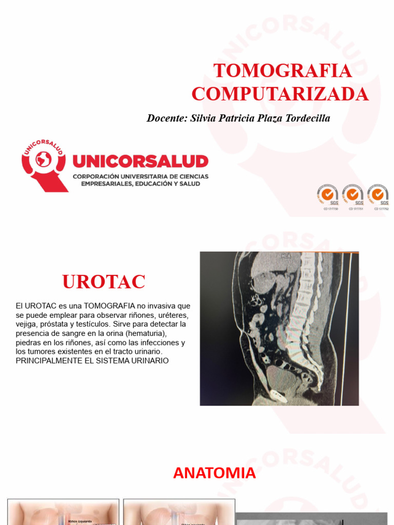UROTAC: Tomografía del Sistema Urinario | PDF | Sistema urinario ...
