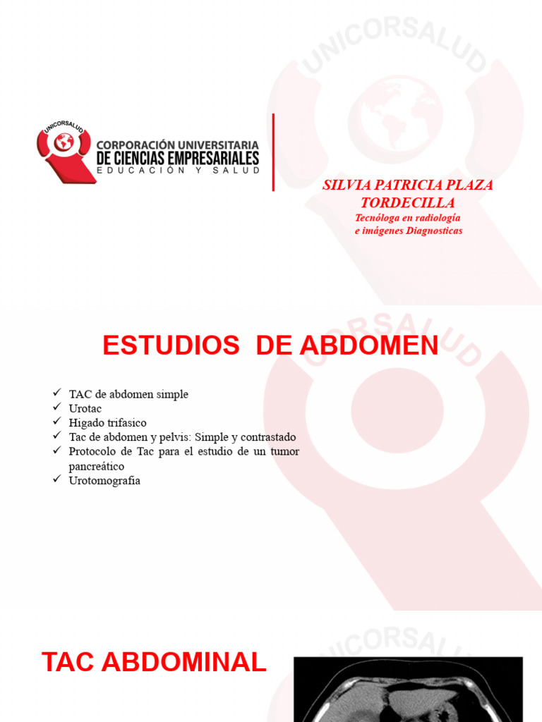 tac de abdomen | Descargar gratis PDF | Ct Scan | Abdomen