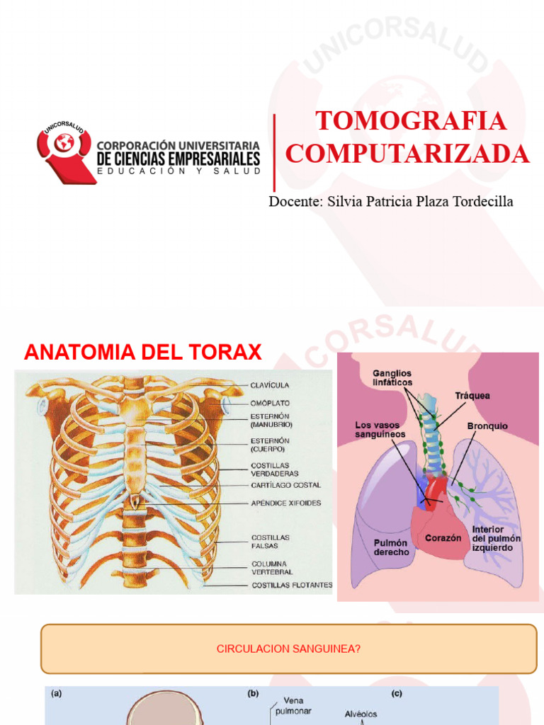 Tomografía de Tórax: Guía Completa | PDF | Enfermedades y trastornos | Medicina CLINICA