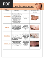 Lesiones Cutaneas y Diferencias - MatExt | PDF | Piel | Especialidades ...