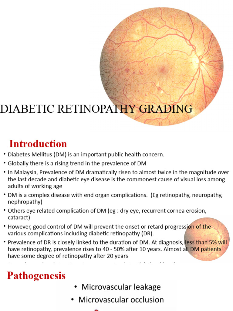 Diabetic Retinopathy Grading | PDF | Diseases And Disorders | Clinical ...