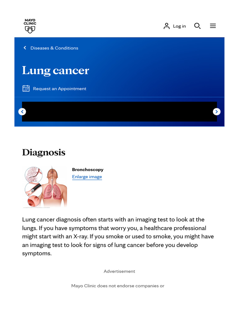 Lung Cancer Diagnosis And Treatment Mayo Clinic Pdf Cancer Lung Cancer