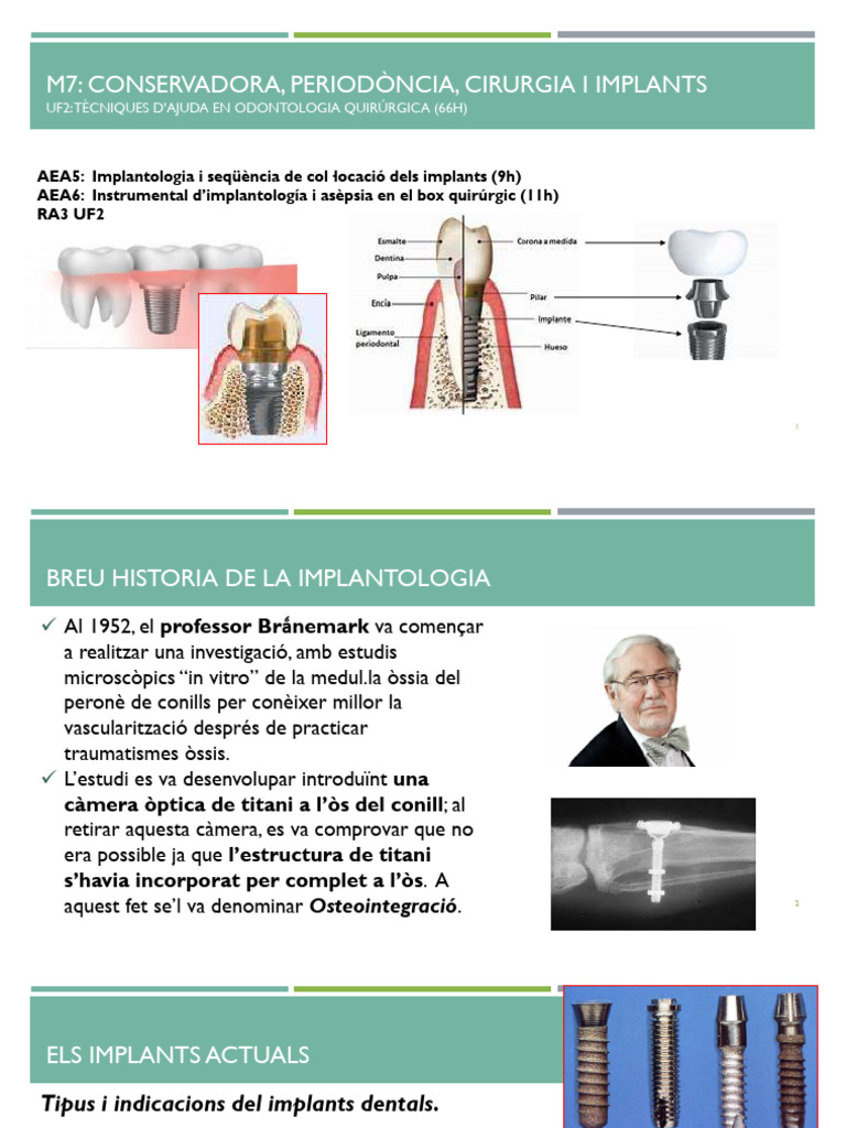 UF2 Implants AEA5 I AEA6 | PDF