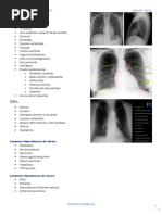 Patologías en RX | PDF | Pulmón | Tórax