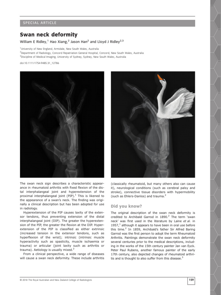 Ridley 2018 | PDF | Clinical Medicine | Diseases And Disorders