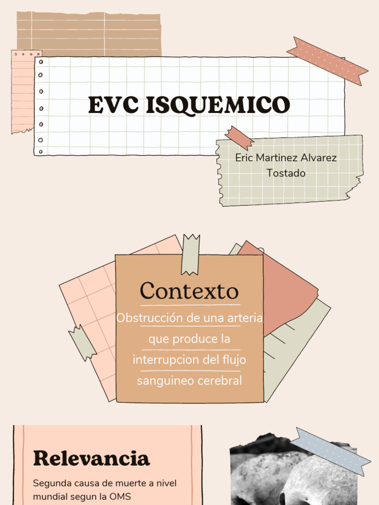 Presentacion Evc | PDF