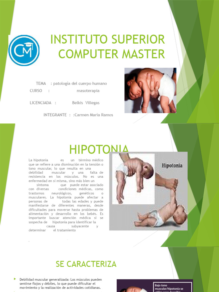 Hipotonía | PDF | Masaje | Terapia física