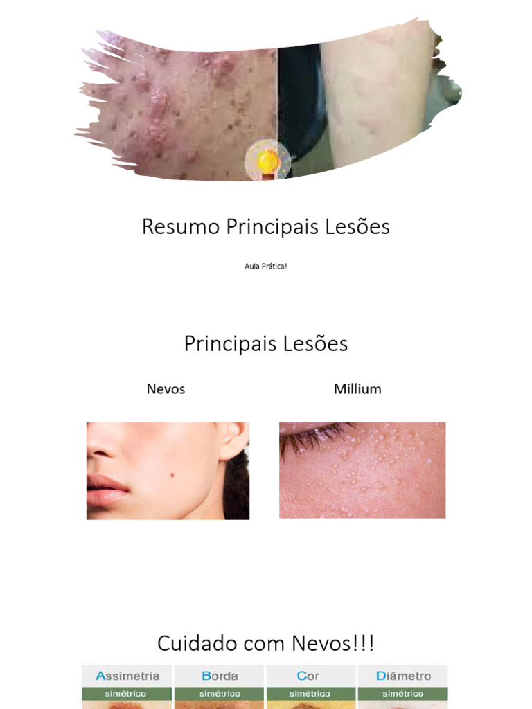 Principais Lesões Dermatológicas e Cuidados | PDF | Bem-estar | Estilo ...