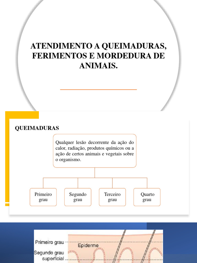 Aula 02 - Ferimentos, Queimaduras e Animais Peçonhentos | PDF ...