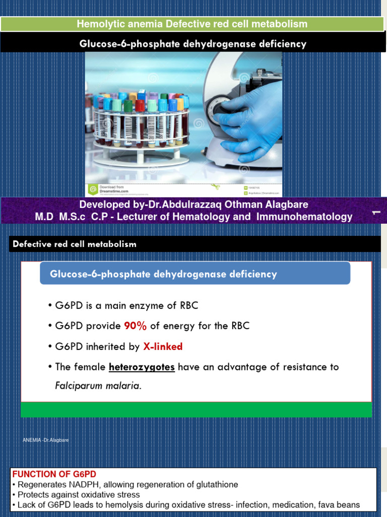 3- G6PD deficiency | PDF | Anemia | Hematology