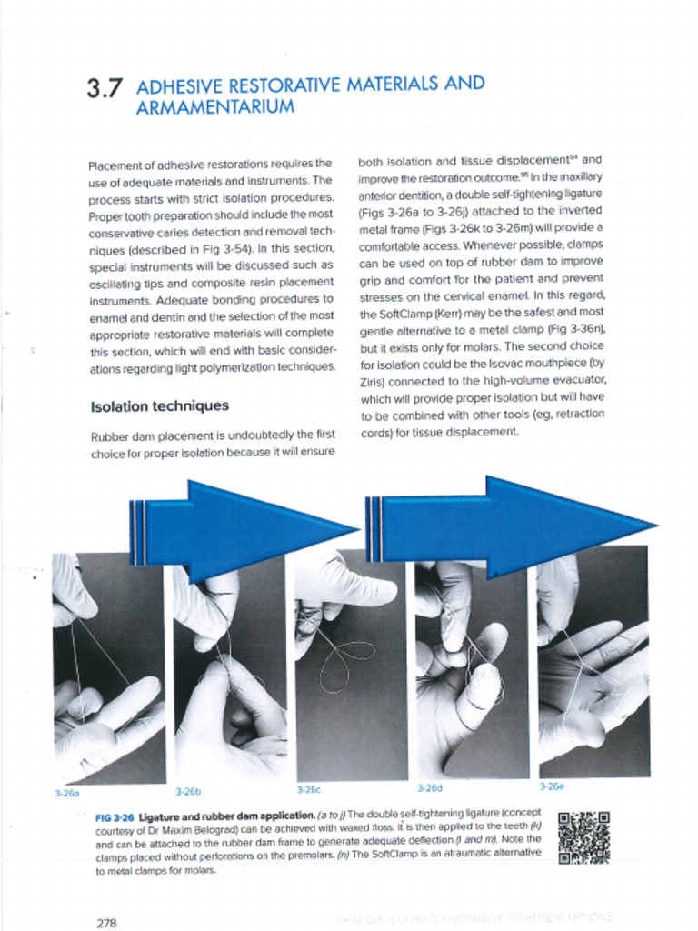 3.7 Adhesive Restorative Materials and Armamentarium. Biomimetic ...