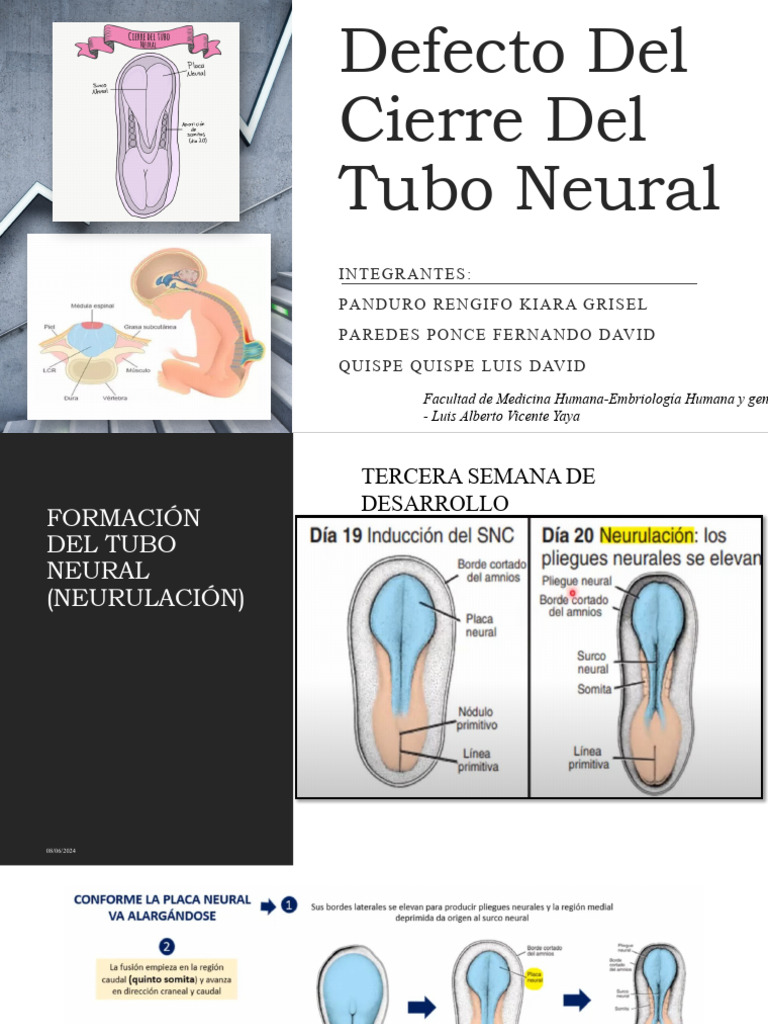 Defecto Del Cierre Del Tubo Neural | PDF | Anatomía | Desorden congenito