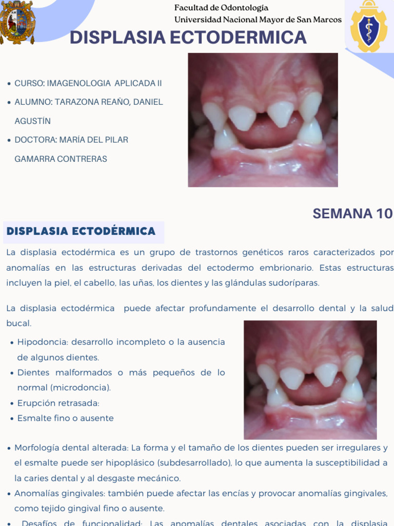Displasia Ectodermica | Descargar gratis PDF | Diente | Examen físico