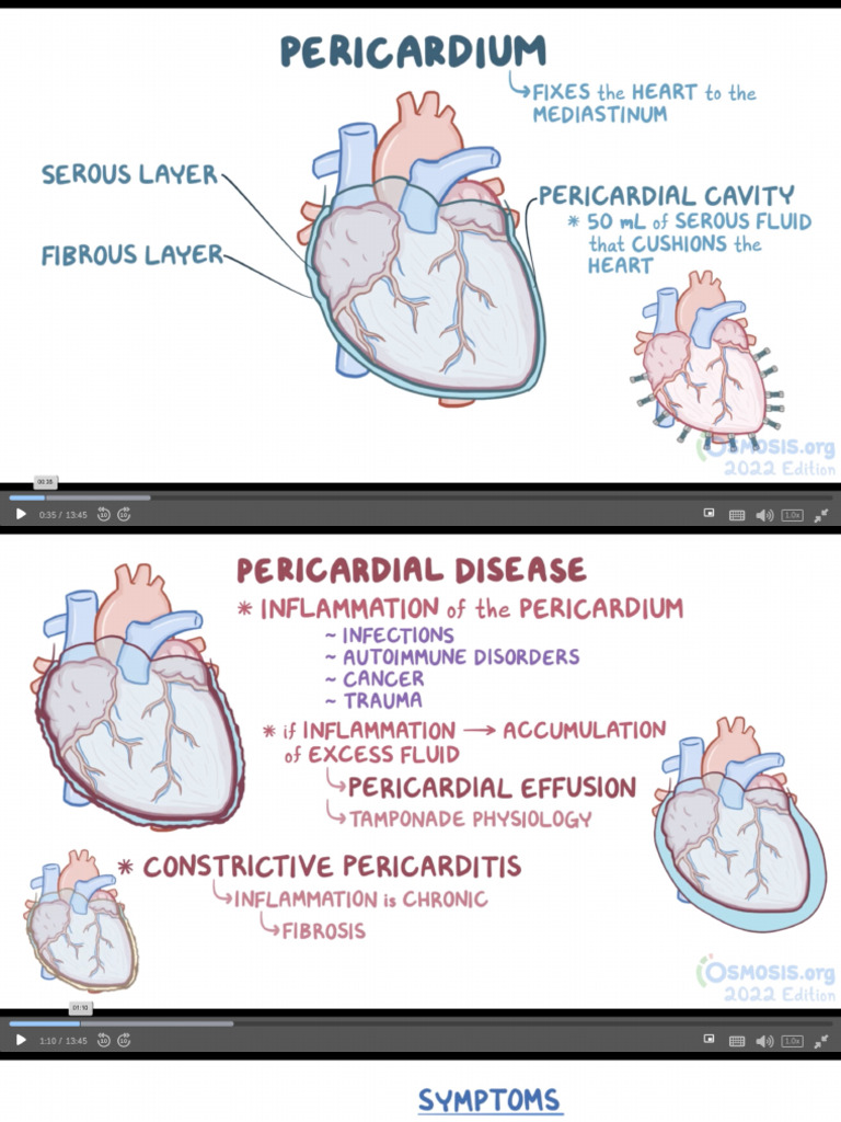 Pericardial Disease Clinical Practice | PDF