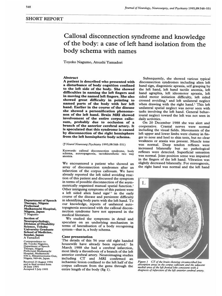 Disconnection Syndrome | PDF | Corpus Callosum | Brain
